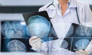 How Brain Scans Help Diagnose and Treat Mental Health Conditions ...